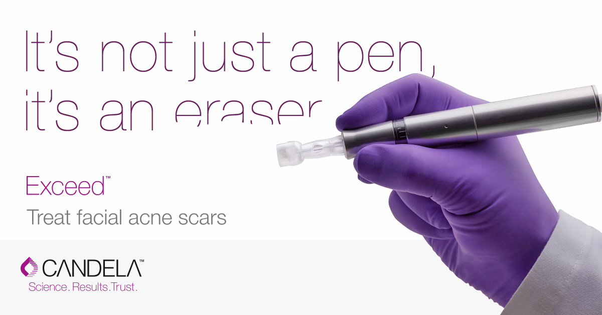 Micro-Needling Orlando - Collagen Induction - Cascades MedSpa